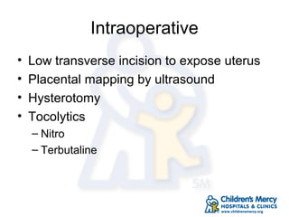 Airway Management for the Unborn Patient by Dr. Corey Iqbal, Chief ...
