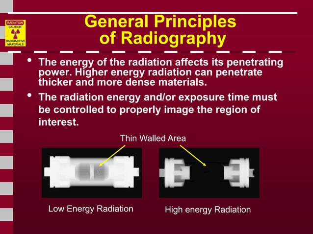 Radiography Testing.ppt | Medical Tests | Medical Health
