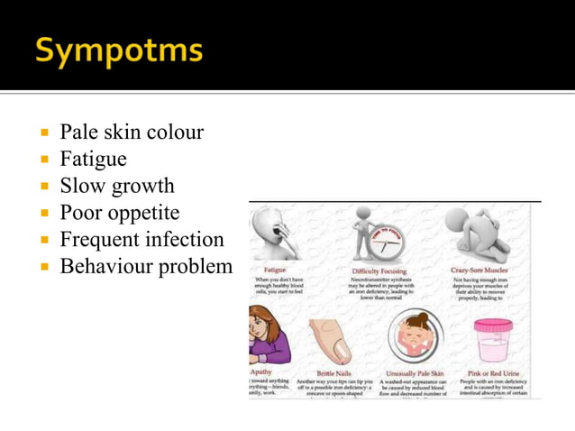 IDA IN CHILDREN | PPT