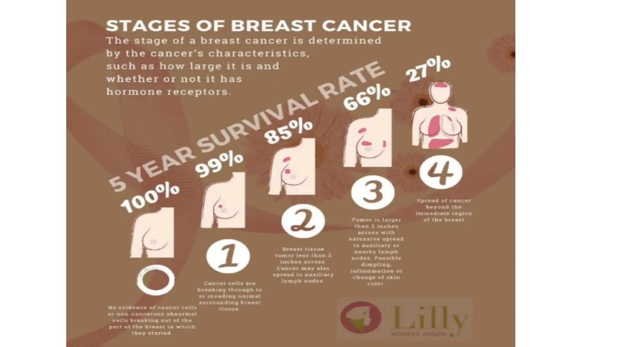 BREAST ANATOMICAL DEFECTS, STAGES OF BREAST DEVELOPMENT, BREAST ...