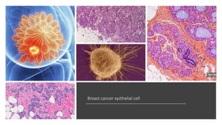 BREAST ANATOMICAL DEFECTS, STAGES OF BREAST DEVELOPMENT, BREAST ...