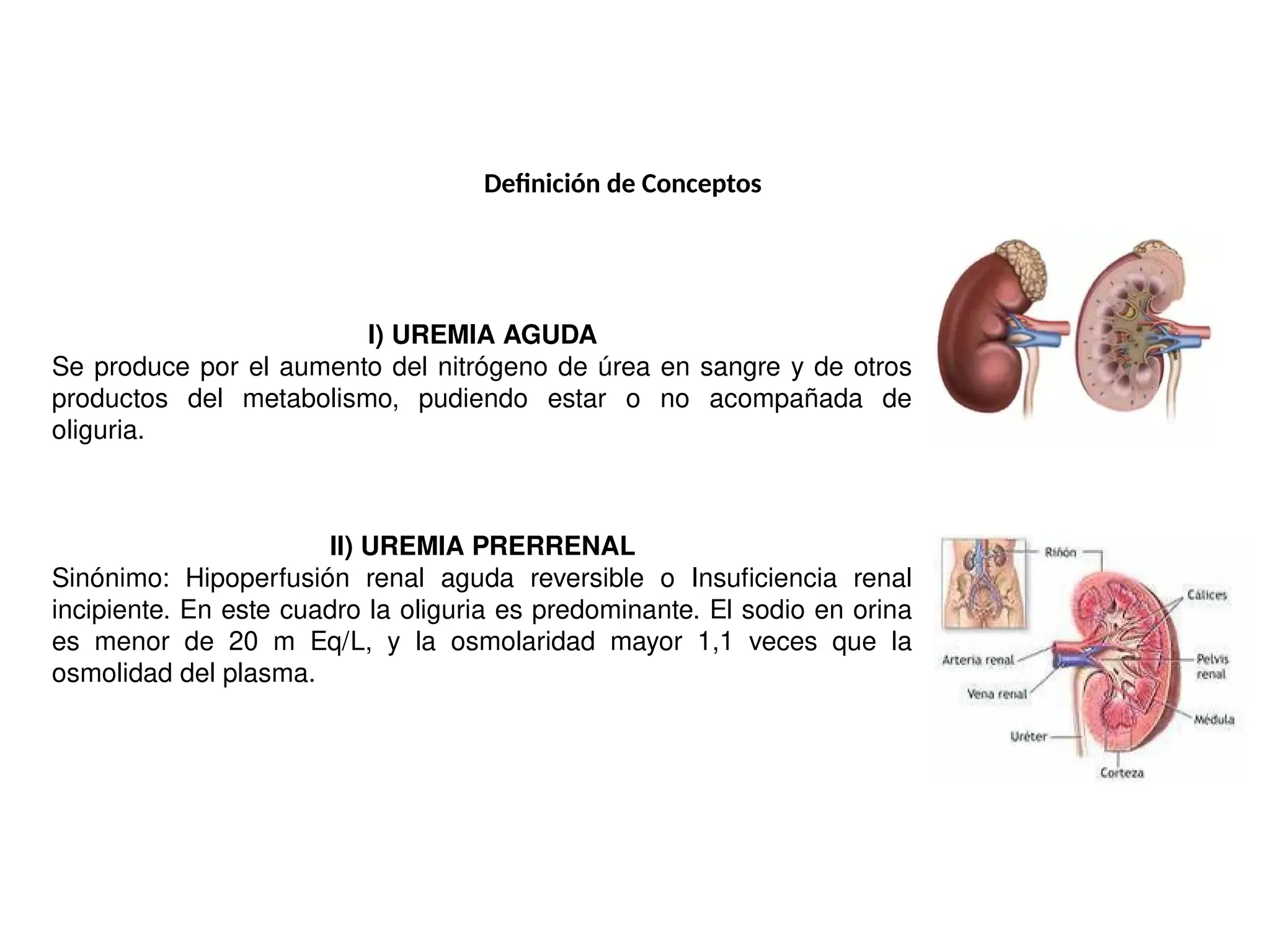 Insuficiencia Renal Aguda abordado en la carrera de medicina | PPTX