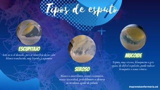 Muestras de laboratorio esputo-AED | PDF