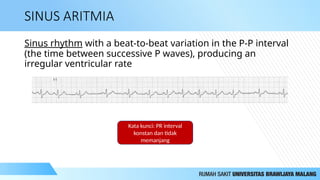 IRAMAa YANG BERASAL DARI SINUS_newW.pptx