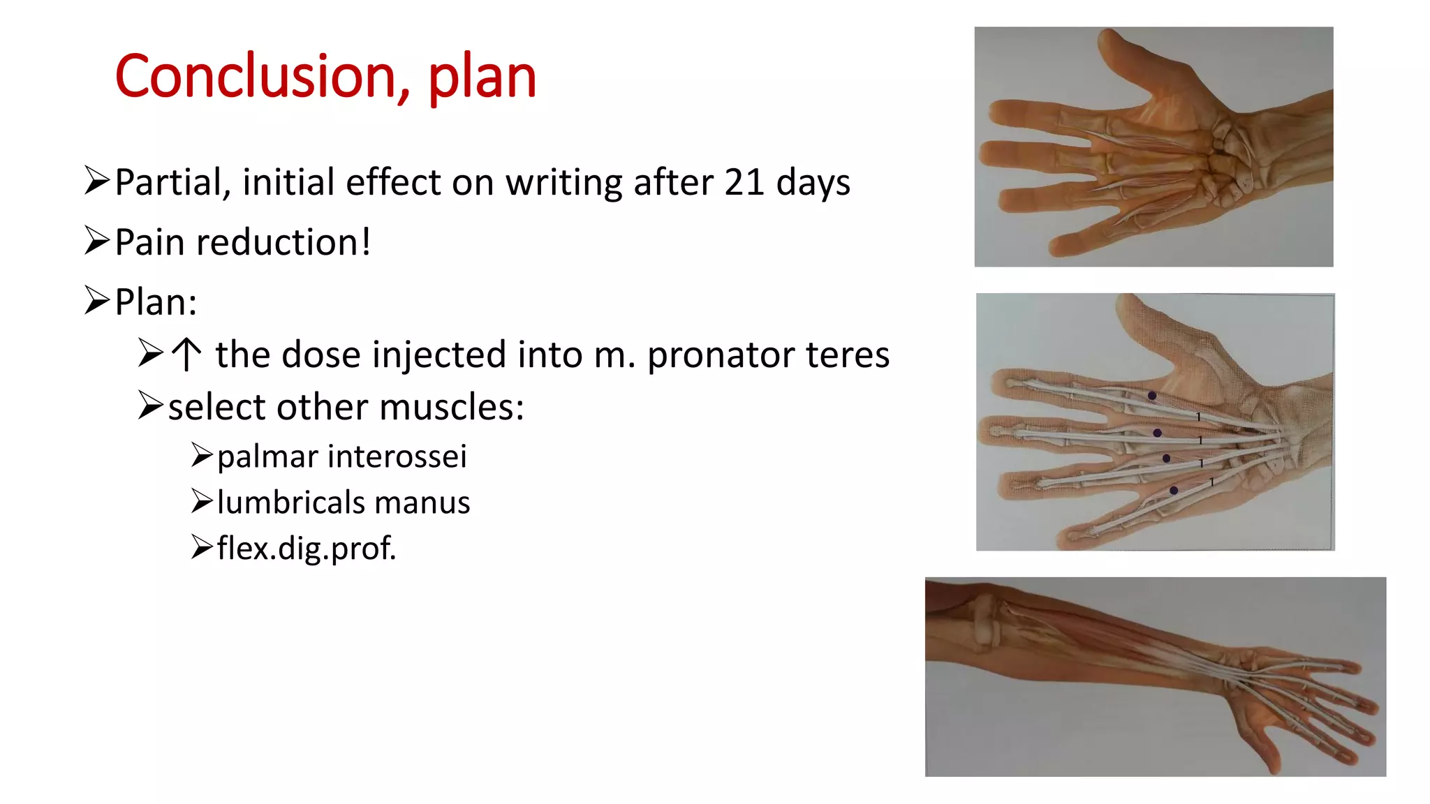Botulinum toxin treatment of focal dystonia: writer’s cramp. Case ...