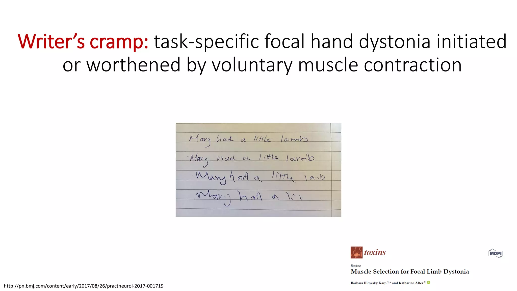 Botulinum toxin treatment of focal dystonia: writer’s cramp. Case ...