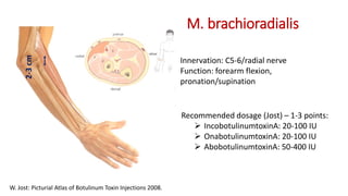 Botulinum toxin treatment of focal dystonia: writer’s cramp. Case ...