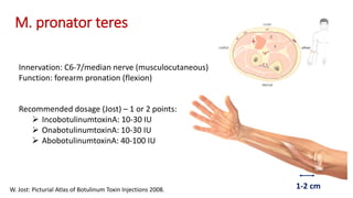 Botulinum toxin treatment of focal dystonia: writer’s cramp. Case ...