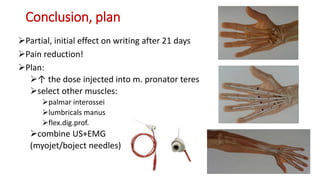 Botulinum toxin treatment of focal dystonia: writer’s cramp. Case ...