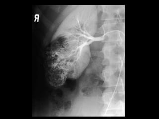 +IR cases 1.ppt