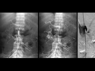 +IR cases 1.ppt