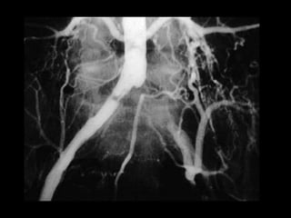 +IR cases 1.ppt