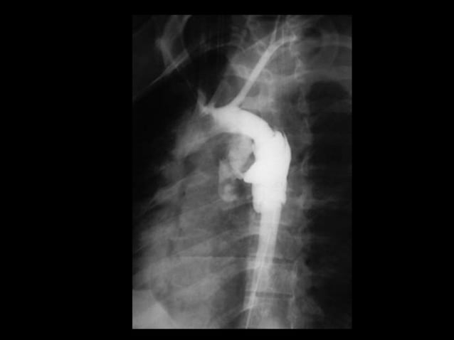 +IR cases 1.ppt