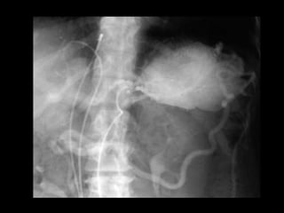 +IR cases 1.ppt