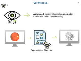 BEye: Software Implementation and Hardware Acceleration of Retinal ...