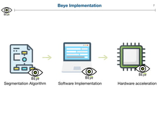 BEye: Software Implementation and Hardware Acceleration of Retinal ...