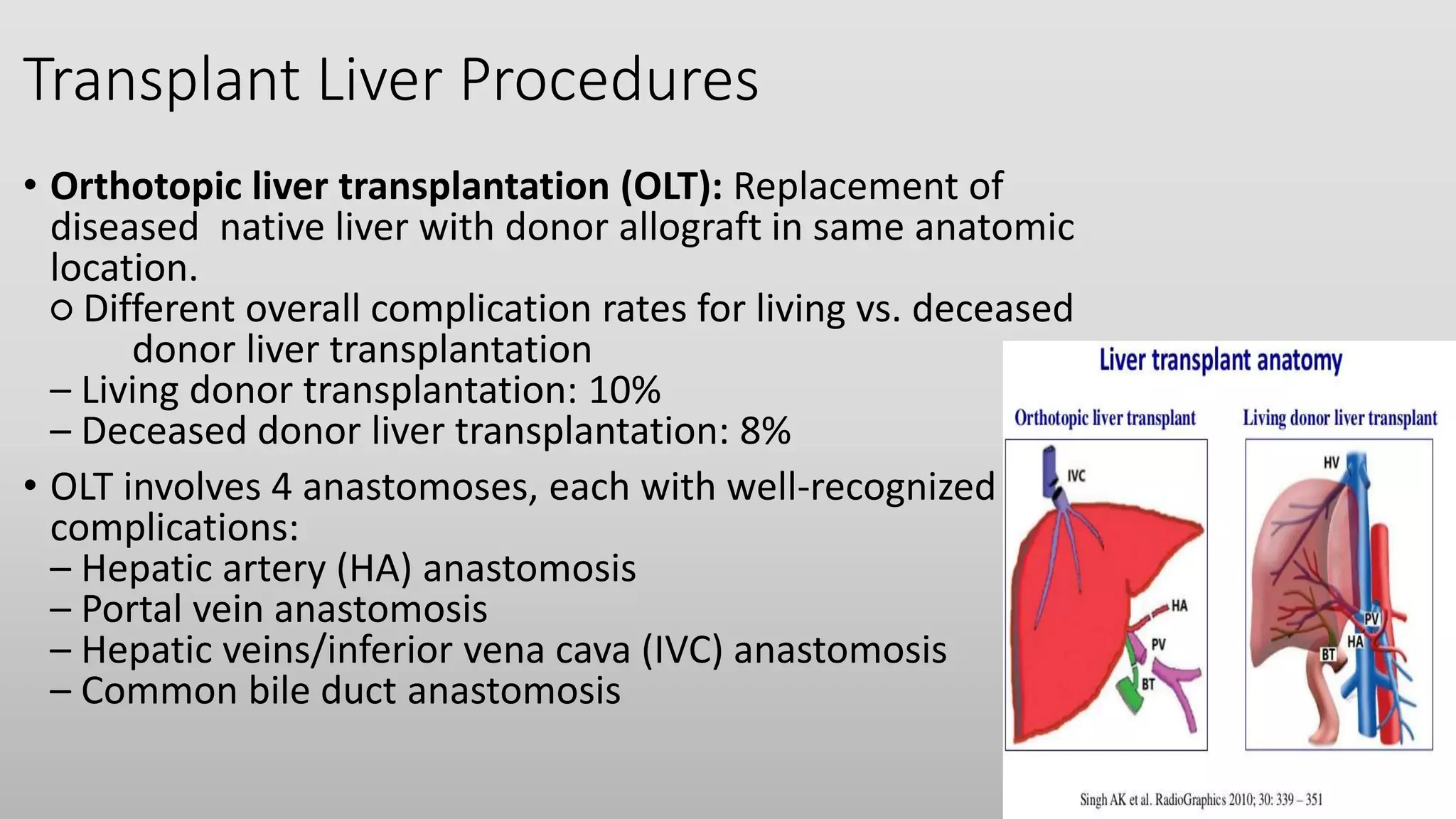 Ir for liver and renal transplant pk .ppt,pdf | PPTX