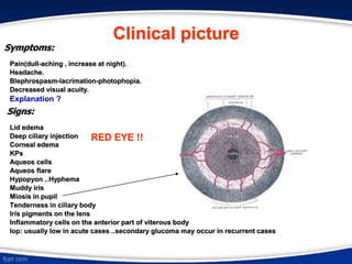 Iridocyclitis