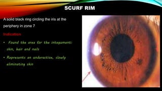 Iridology overview | PPT
