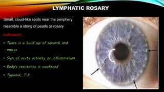 Iridology overview | PPT