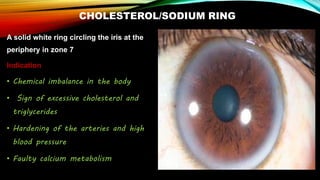 Iridology overview | PPT