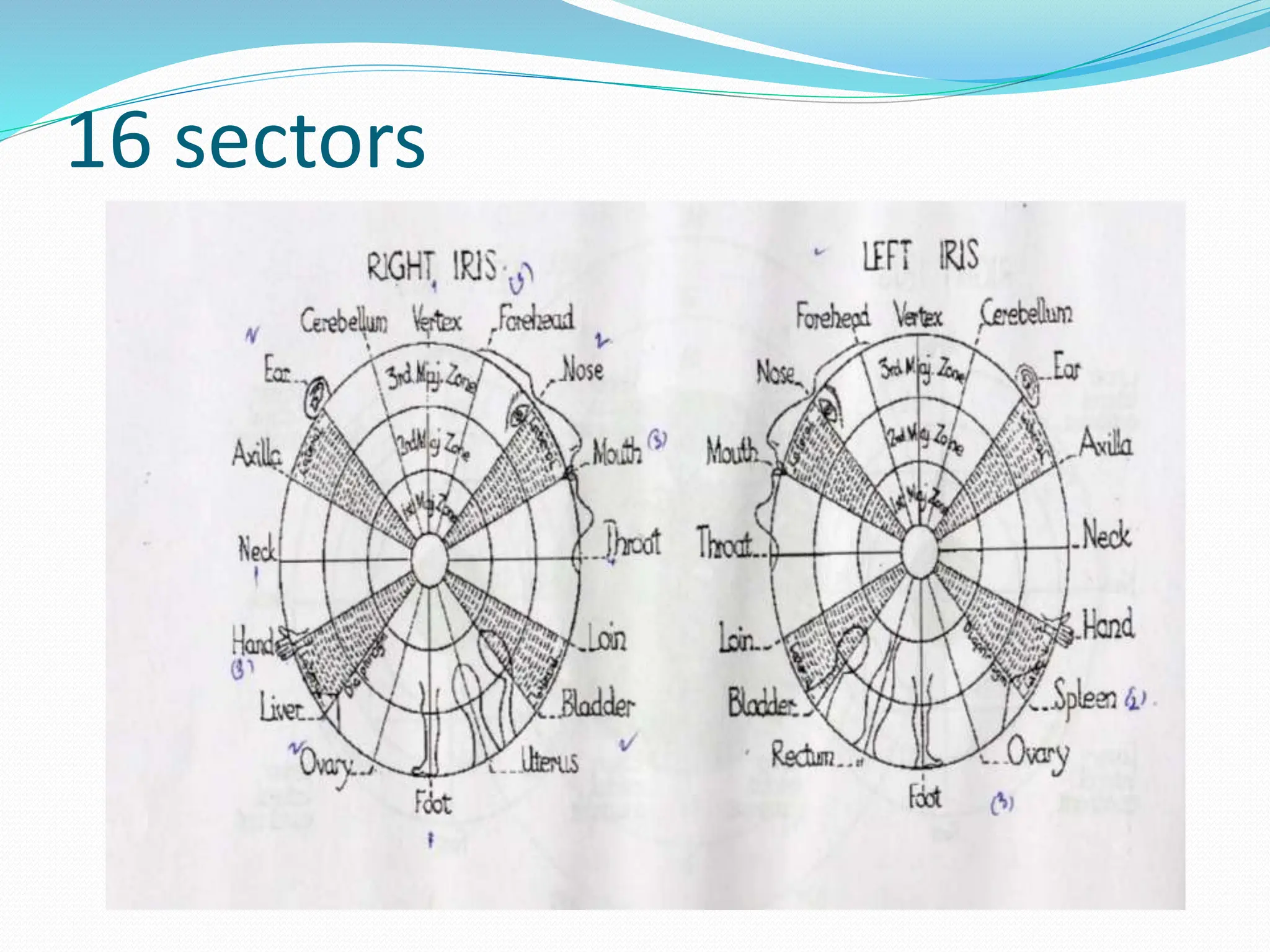 IRIS CHART.pptx iris chart of eyes in human | PPTX