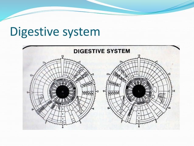 IRIS CHART.pptx iris chart of eyes in human | PPTX | Eye and Vision ...