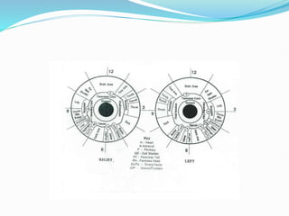 IRIS CHART.pptx iris chart of eyes in human | PPTX