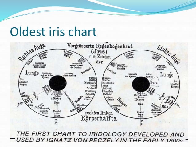 IRIS CHART.pptx iris chart of eyes in human | PPTX | Eye and Vision Conditions | Diseases and ...