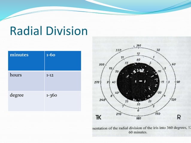IRIS CHART.pptx iris chart of eyes in human | PPTX | Eye and Vision ...
