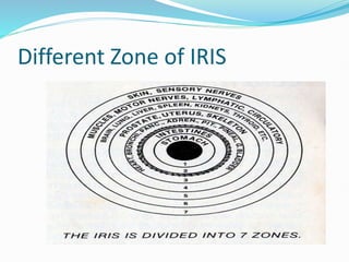 IRIS CHART.pptx iris chart of eyes in human | PPTX