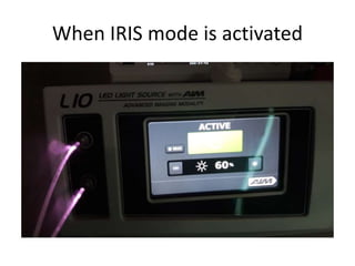 Iris in tlh step by step | PPT