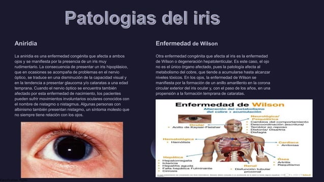 IRIS, PUPILA, UVEA, CAMARA ANTERIOR, CAMARA PORTERIOR, PATOLOGIAS IRIR, LA COLORACION DEL IRIS.pptx
