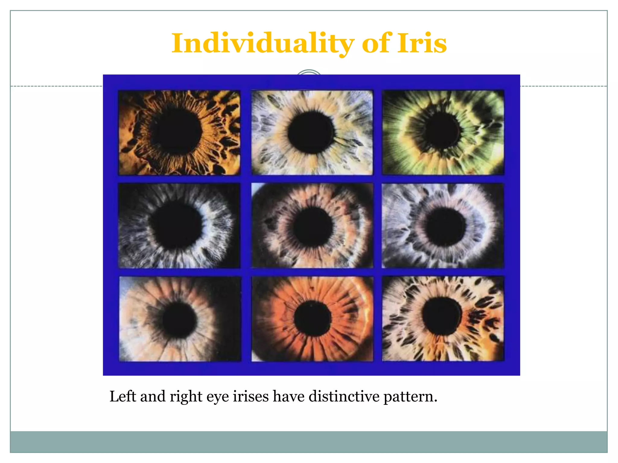 Iris recognition seminar | PPTX