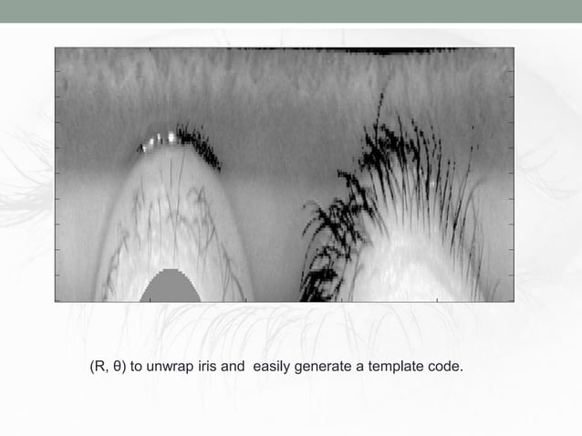 Iris recognition system | PDF | Eye and Vision Conditions | Diseases and Conditions