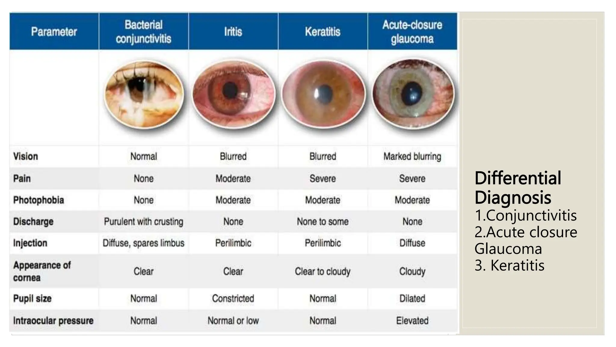 Iritis and Corneal Ulcer Presentation.pptx