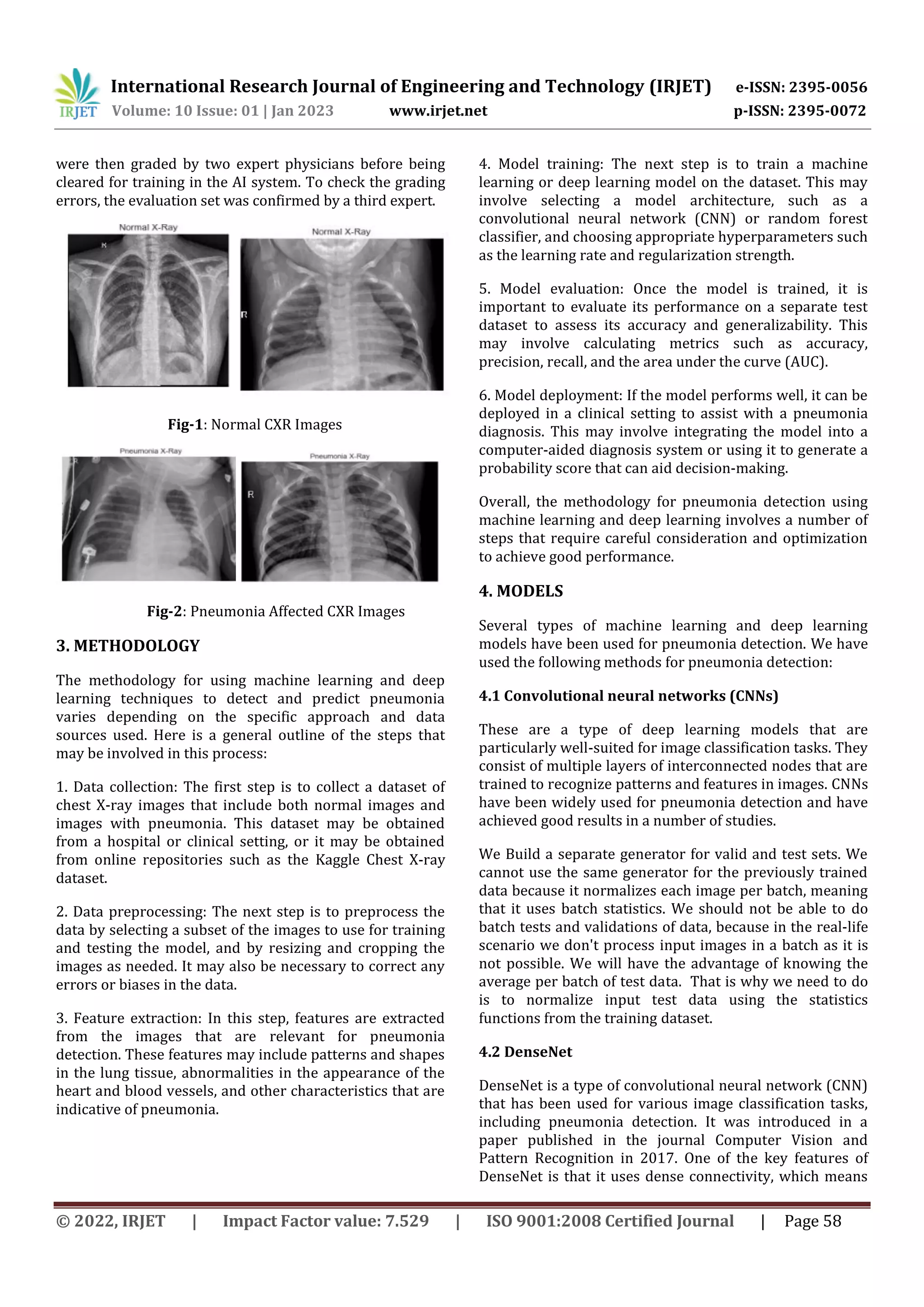 Pneumonia Detection Using Deep Learning and Transfer Learning | PDF Pneumonia Detection Using Deep Learning and Transfer Learning | PDF