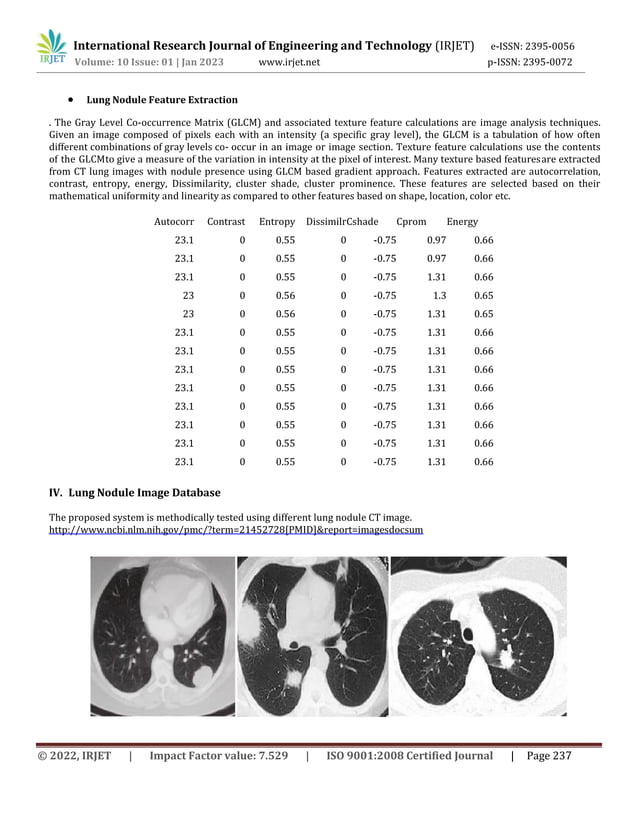 Lung Nodule Feature Extraction And Classification Using Improved Neural