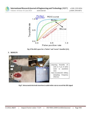 Detection of EEG Spikes Using Machine Learning Classifier | PDF
