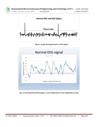 Detection of EEG Spikes Using Machine Learning Classifier | PDF