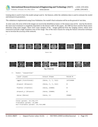 Brain Tumor Detection Using Deep Learning | PDF