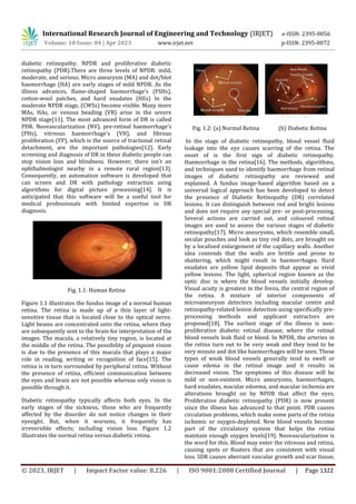 AUTOMATIC DETECTION OF SEVERITY GRADING IN DIABETIC RETINOPATHY USING CONVOLUTIONAL NEURAL ...