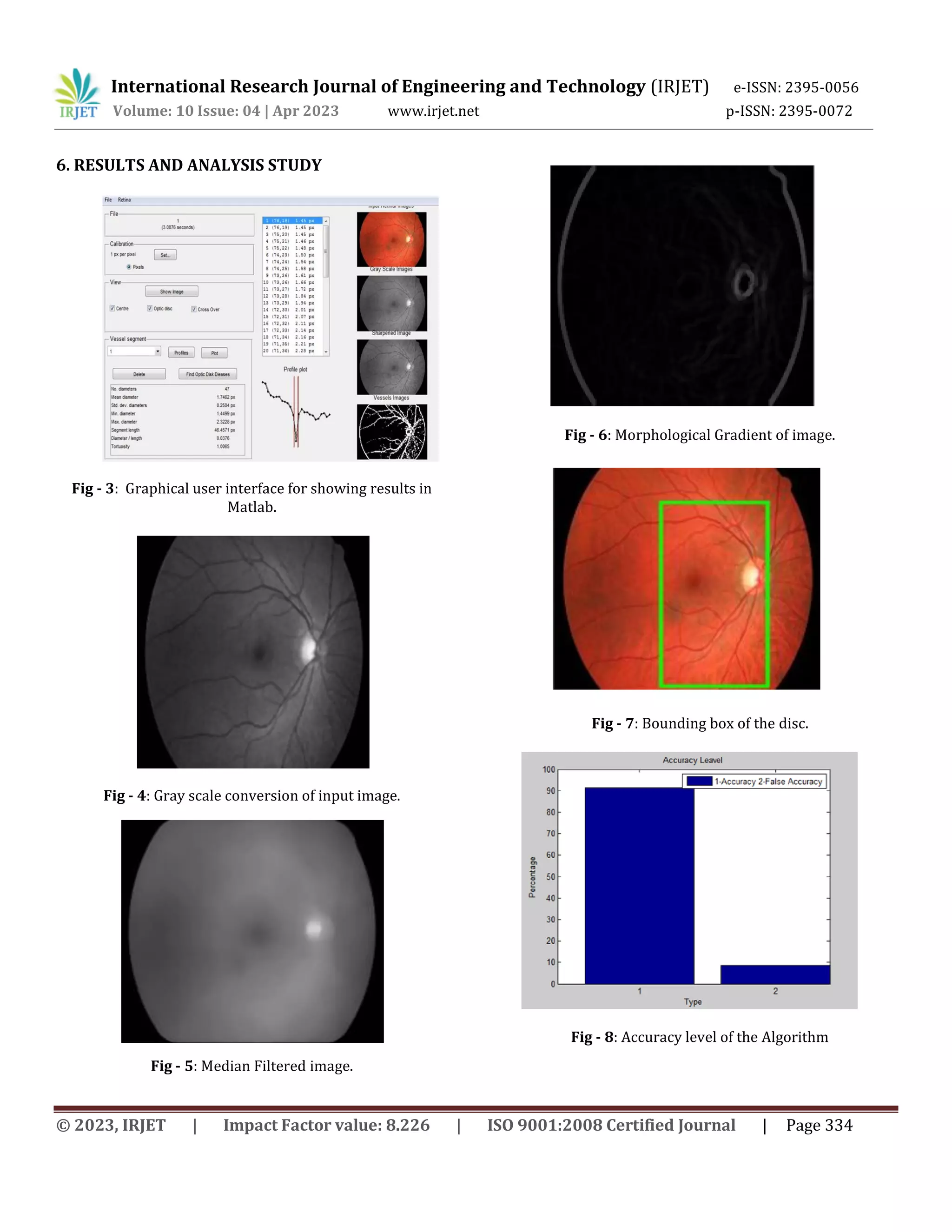 RETINA DISEASE IDENTIFICATION USING IMAGE PROCESSING | PDF