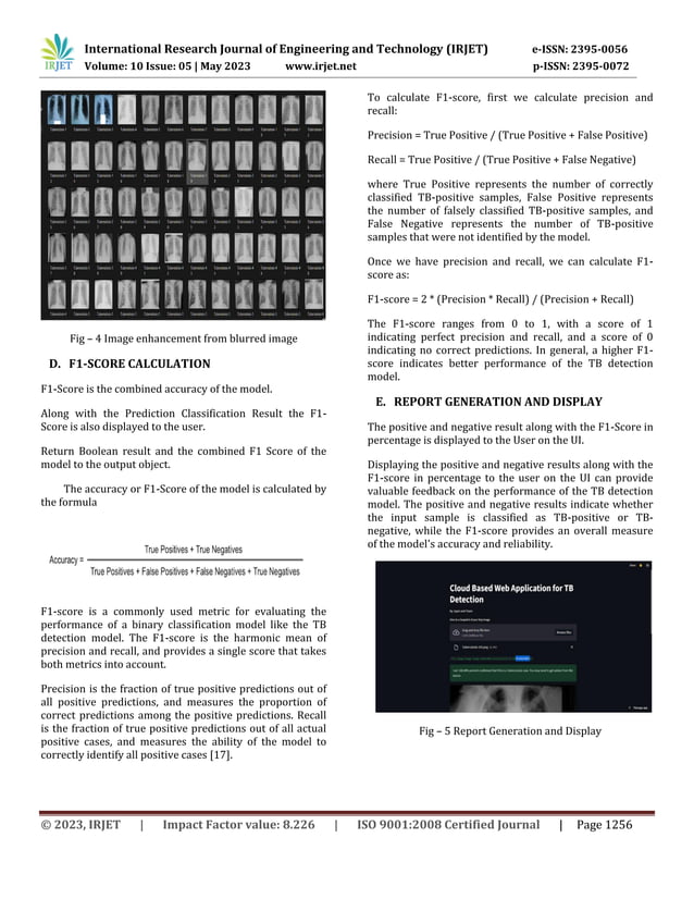 CLOUD BASED WEB-APPLICATION FOR RAPID AND PRECISE DETECTION OF TUBERCULOSIS USING DEEP LEARNING ...