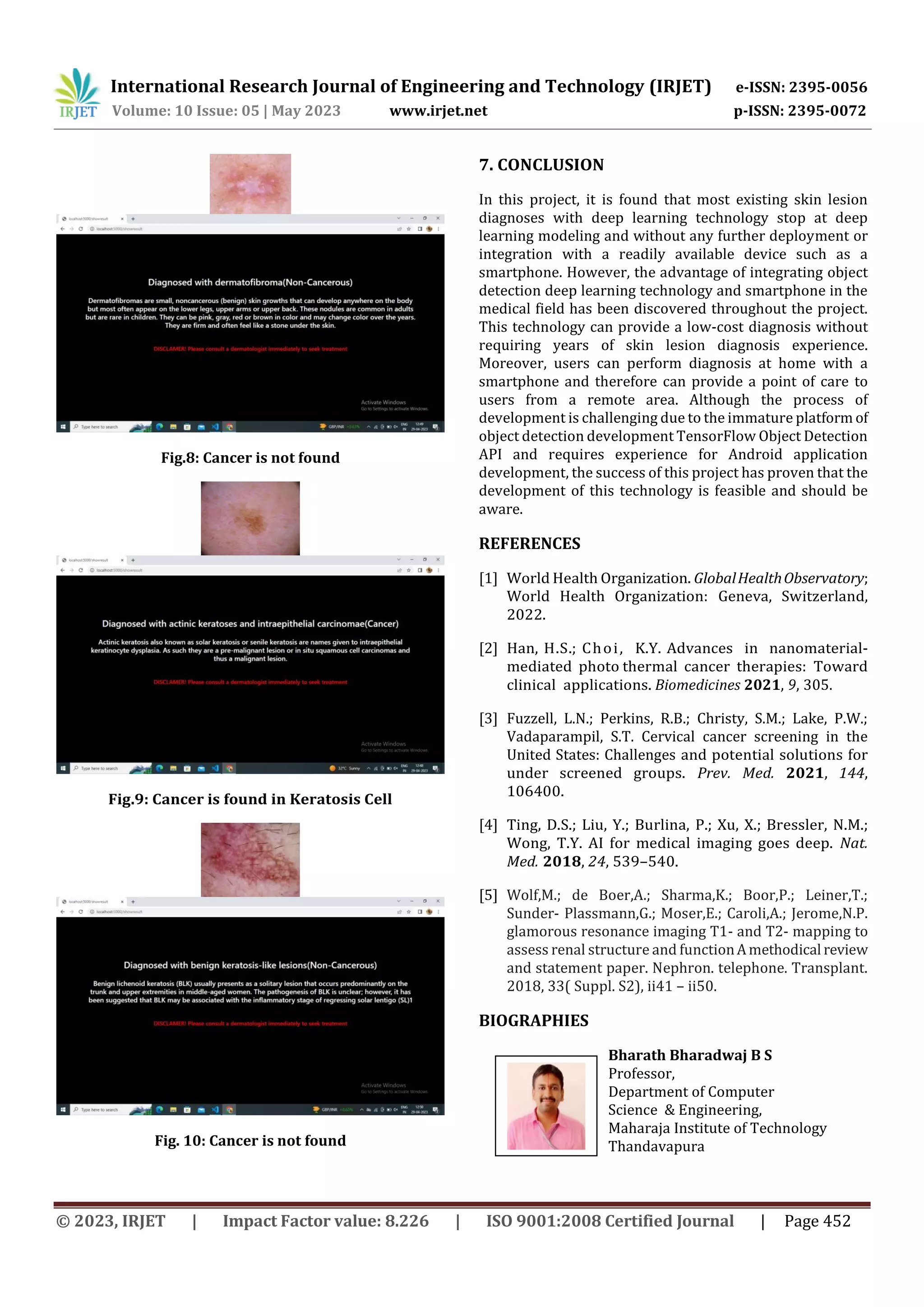 Detection of Skin Cancer Based on Skin Lesion Images UsingDeep Learning | PDF | Skin and ...