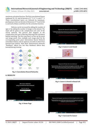 Detection of Skin Cancer Based on Skin Lesion Images UsingDeep Learning ...