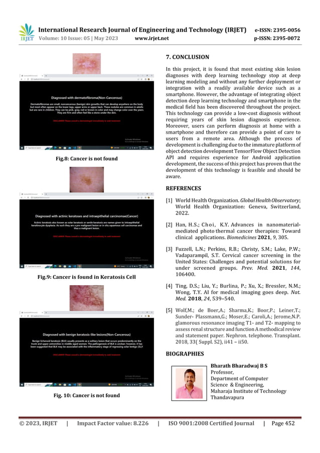 Detection of Skin Cancer Based on Skin Lesion Images UsingDeep Learning | PDF | Skin and ...