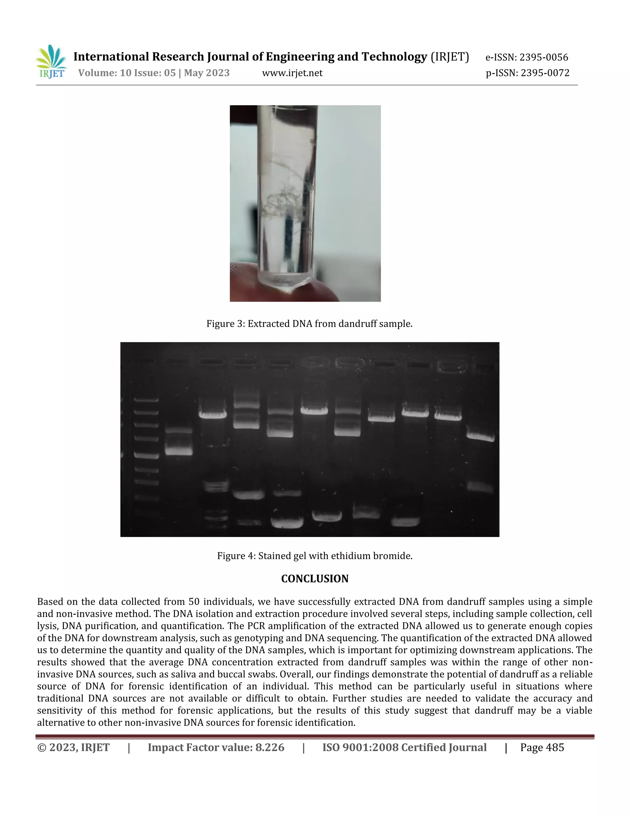 Isolation and Extraction of DNA from Dandruff: A Novel Approach for ...