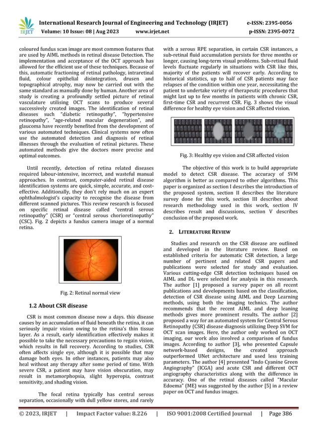 SVM based CSR disease detection for OCT and Fundus Imaging | PDF | Eye ...