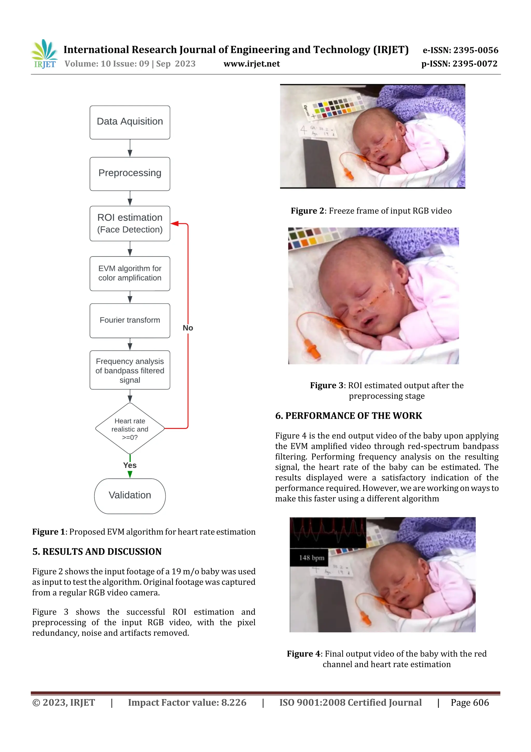 Measuring Heart Rate from Video using EVM | PDF